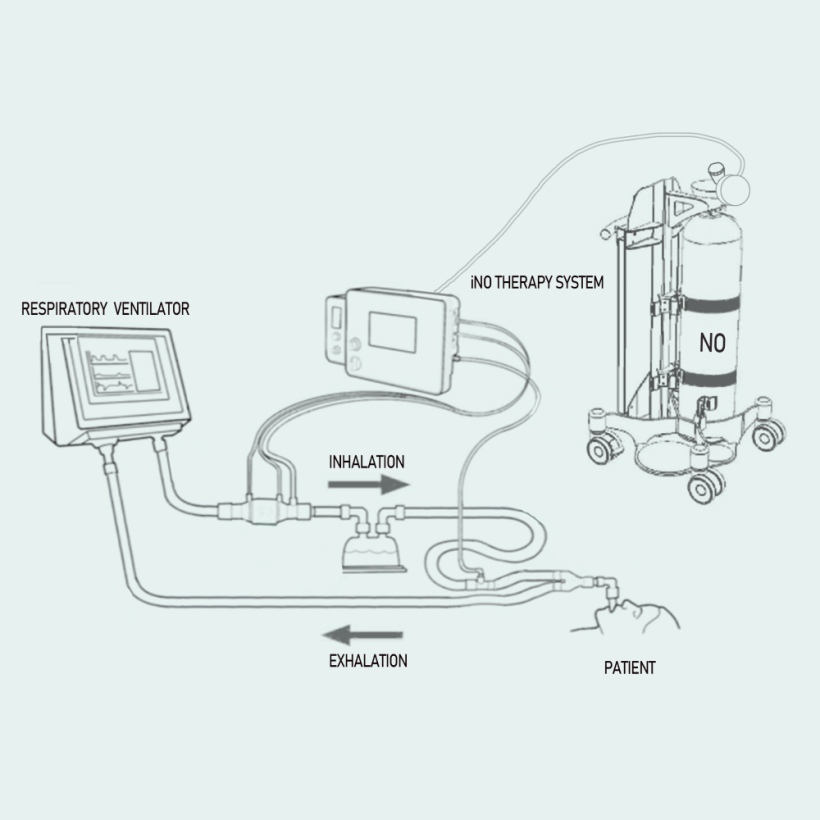 System for inhaled nitrogen monoxide therapy - Pmb